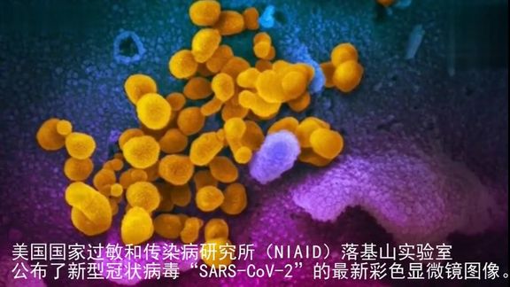 新型冠状病毒最新彩色显微镜图像