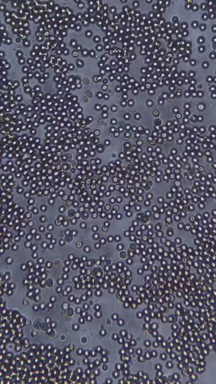 一滴血放大1000倍血血液显微镜