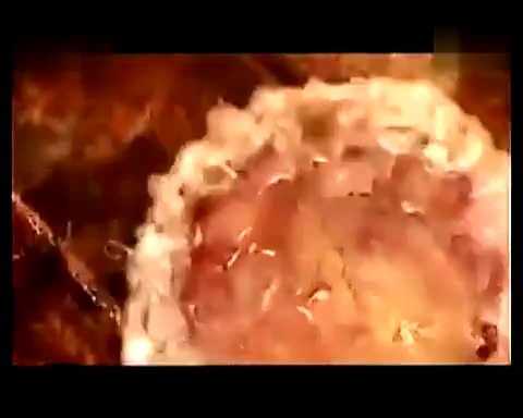 3D动画模拟婴儿受孕到降生全过程