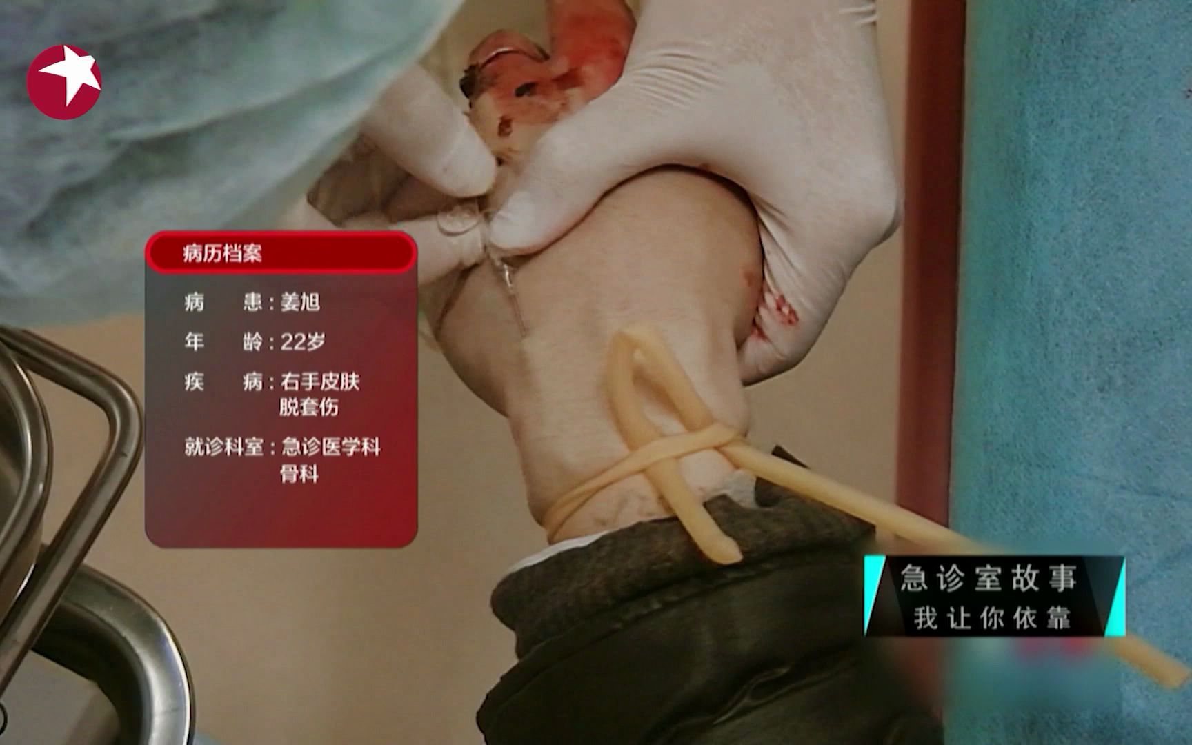 【急诊室故事 第一季】看点7-1:男子整只手绞进滚筒里,血肉模糊,却...