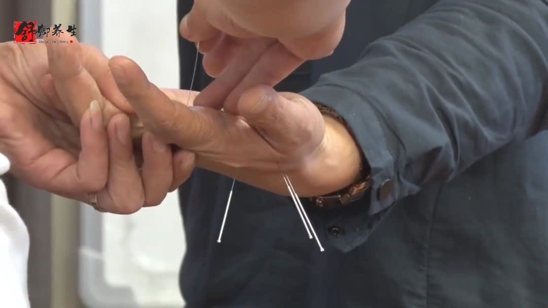咳嗽慢性咽炎,气血三针再加这一针,下针见效,中医针灸教学