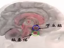 如何治疗输卵管导致的不孕症