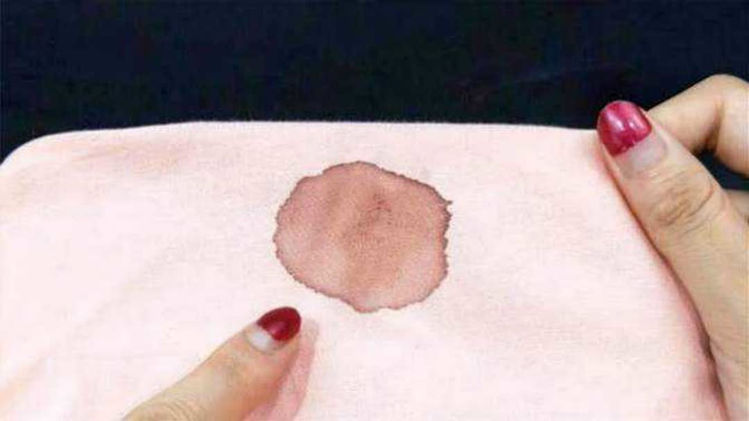 不管床单血渍多顽固,教你简单技巧,新老血渍立马去除,学会真棒