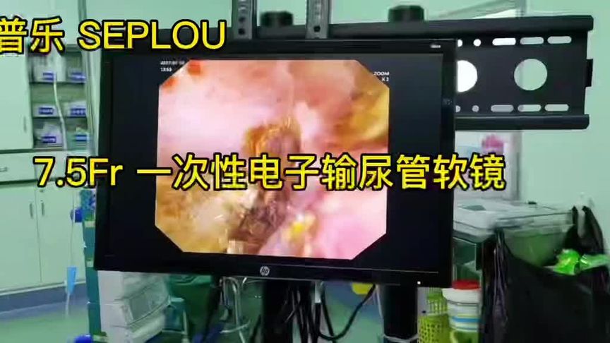 7.5Fr电子输尿管软镜#钬激光 #结石 #耗材 #碎石 #斯普乐