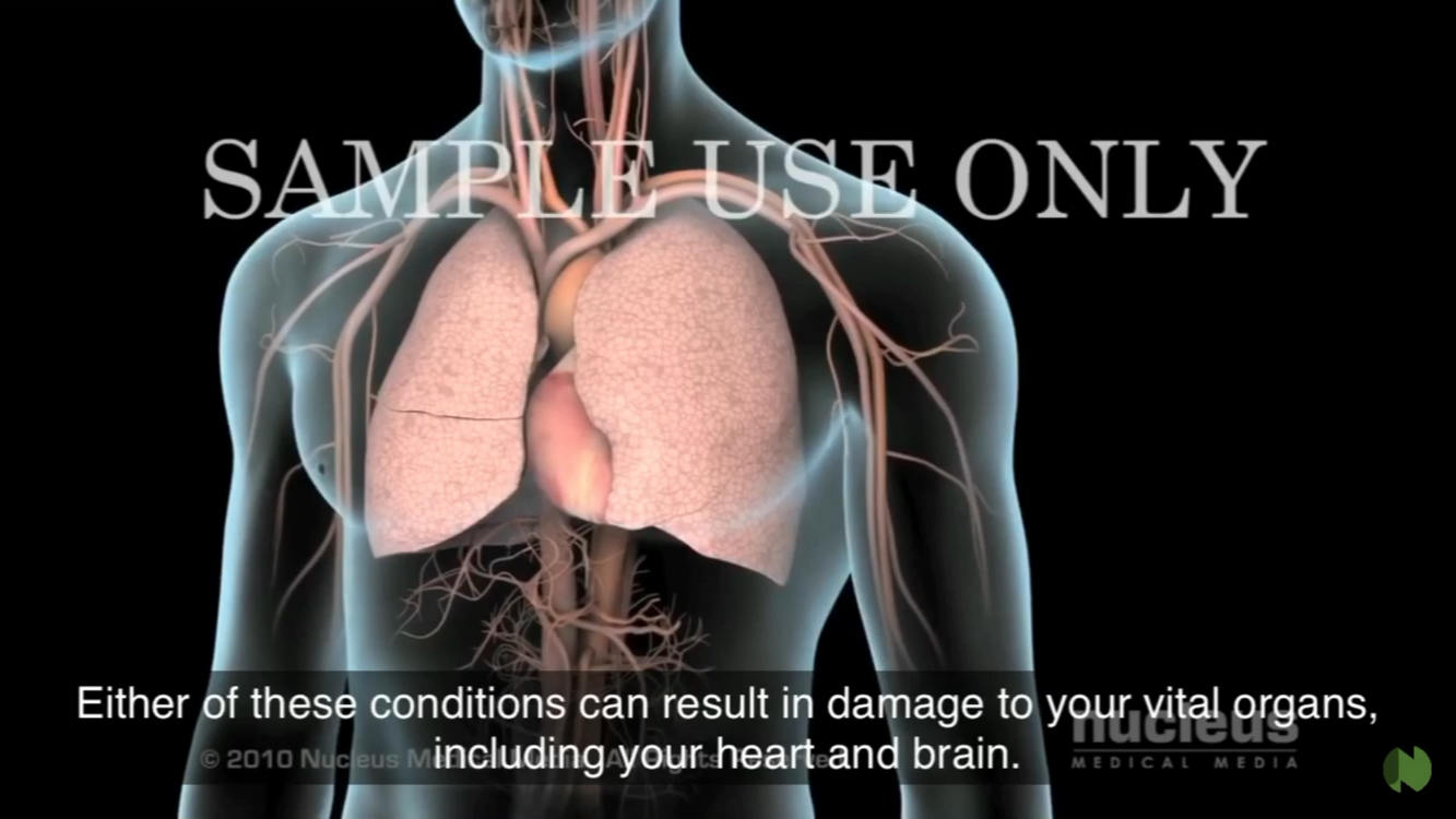 【rehabilitation】+气管插管与机械通气+英字