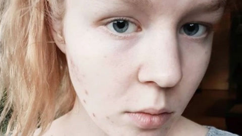 童年多次受伤害患严重抑郁 荷兰被性侵少女选择安乐死