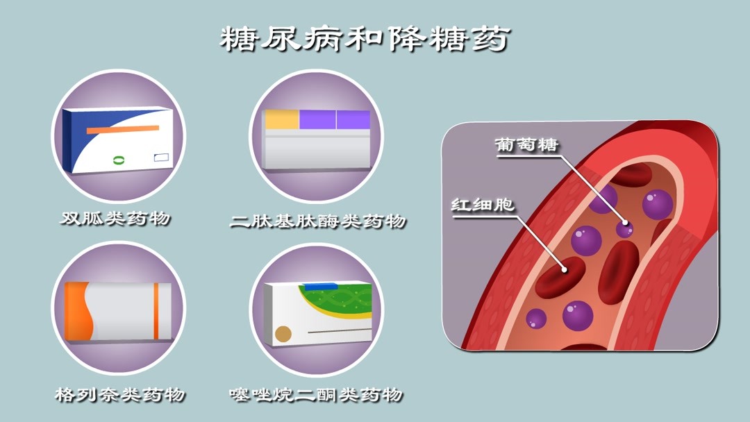 降糖药物如何选?用药都有哪些坑?药物降糖最靠谱的知识都在这