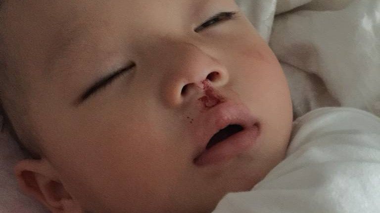 这才是给孩子止鼻血的正确方法,千万别再用你那些危险的方法了