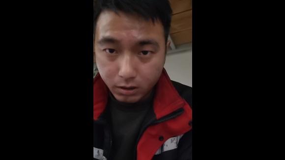 一个星期受了两次工伤,这次差点毁容,现在都不想做了,