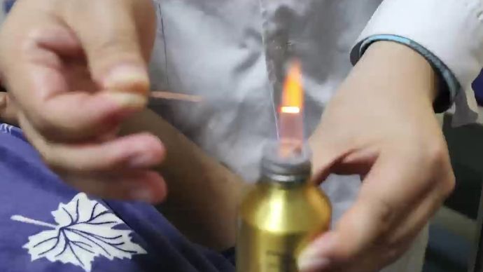 果然视频|梁山县中医院:火针+拔罐治疗中风后肢体痉挛