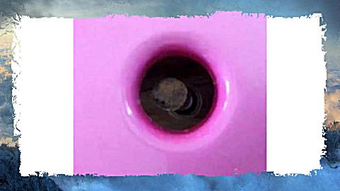 痔疮,艾灸绿色家庭疗法