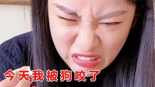 短剧:祝晓晗被狗咬,嘴上和老爸说没事,原来"症状"已经很严重