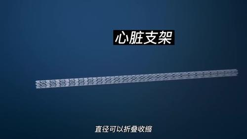 心脏支架安装原来如此简单,怪不得医院的治疗费用越来越低