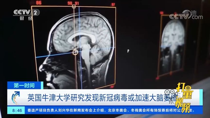 英国牛津大学研究发现新冠病毒或加速大脑萎缩|第一时间