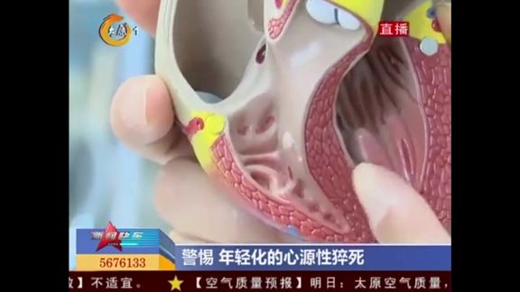 心源性猝死逐渐年轻化,如果有这五种征兆,一定要及时就医