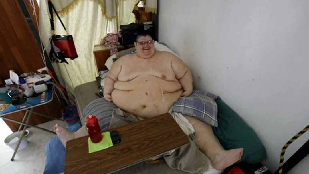 世界最胖男子一年减重500斤 可借助外力支撑站起来