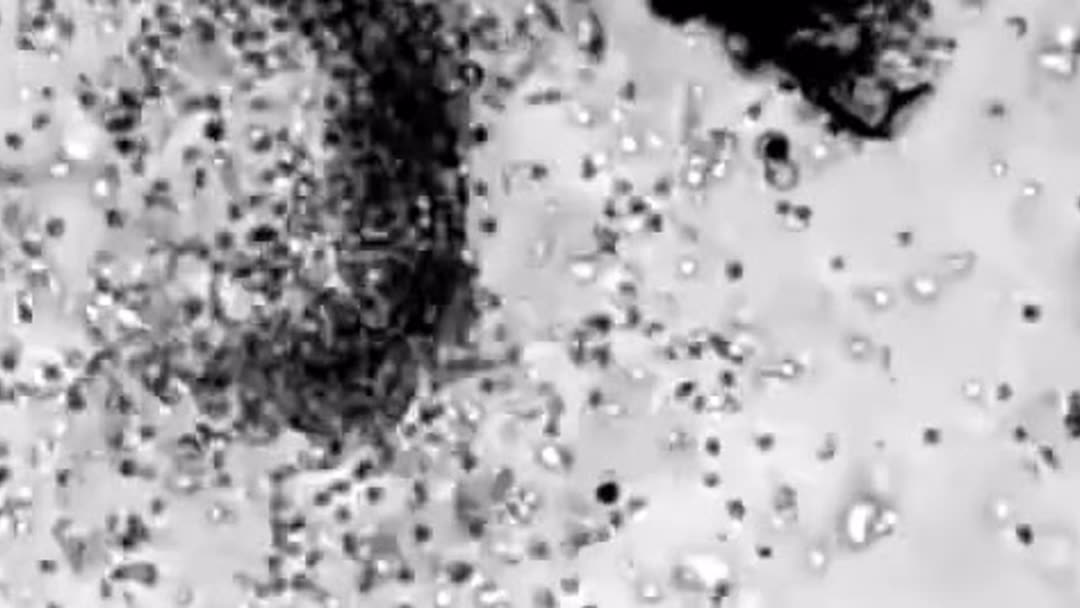 白血球攻击细菌的过程