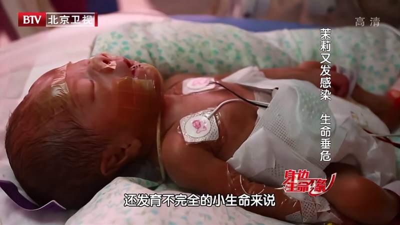 早产儿突发感染,医生为她进行中心静脉置管,下秒更揪心
