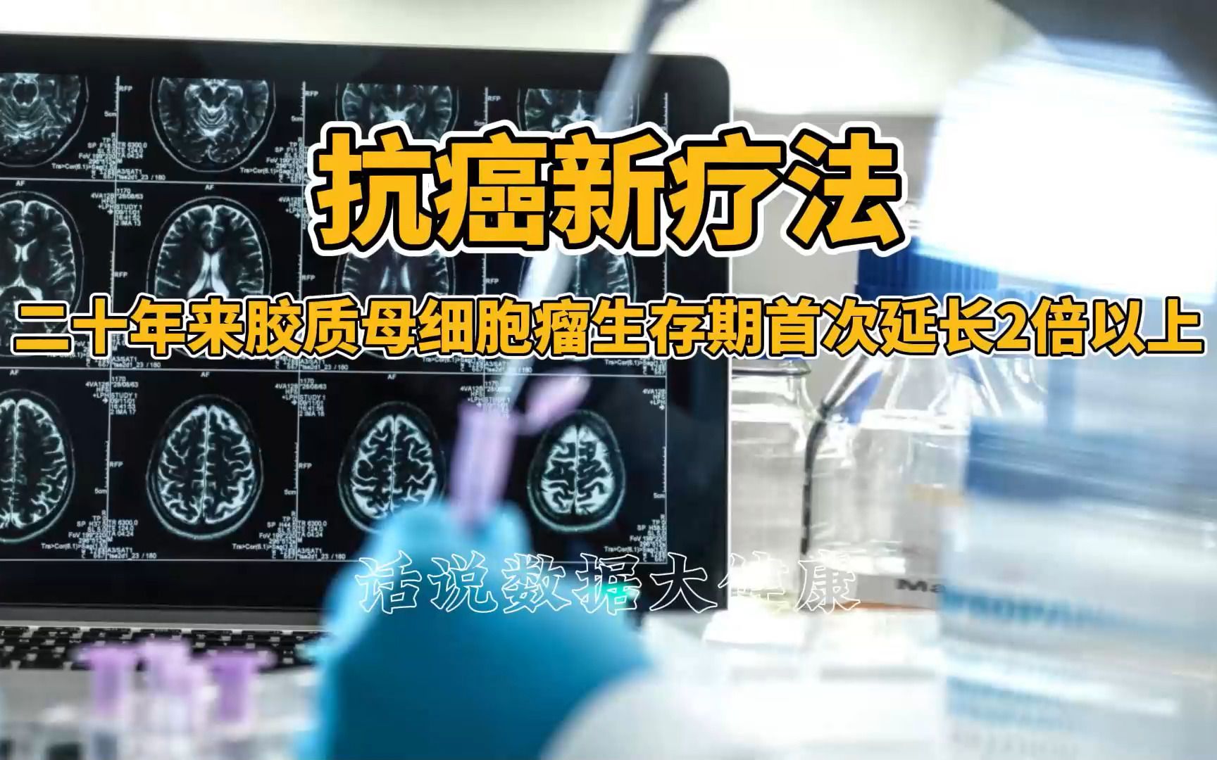 抗癌新疗法,二十年来胶质母细胞瘤生存期首次延长2倍以上