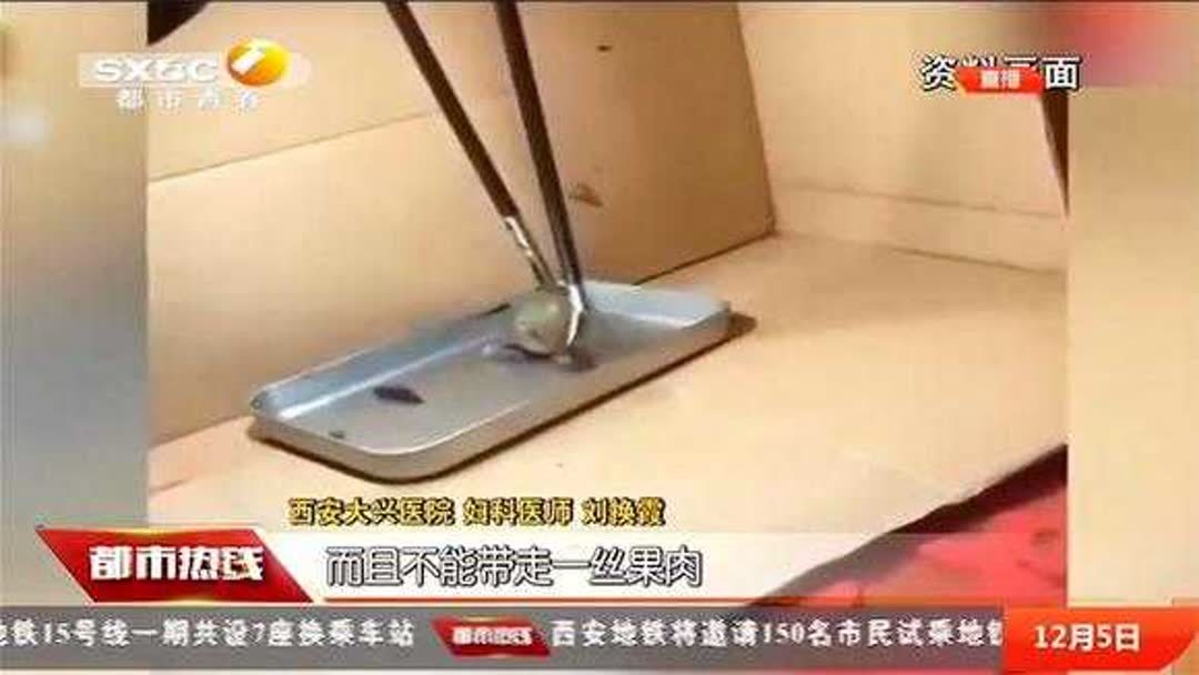 为练习单孔腹腔镜无痕手术,外科医生拿器械剥葡萄皮|都市热线