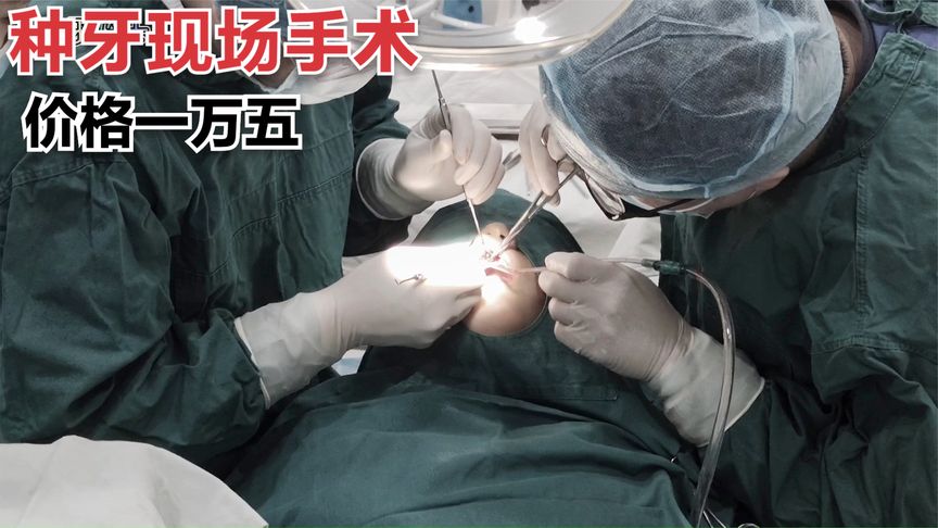 国内种植牙价格八千到一万五,现场近距离纪录种牙流程,不容错过