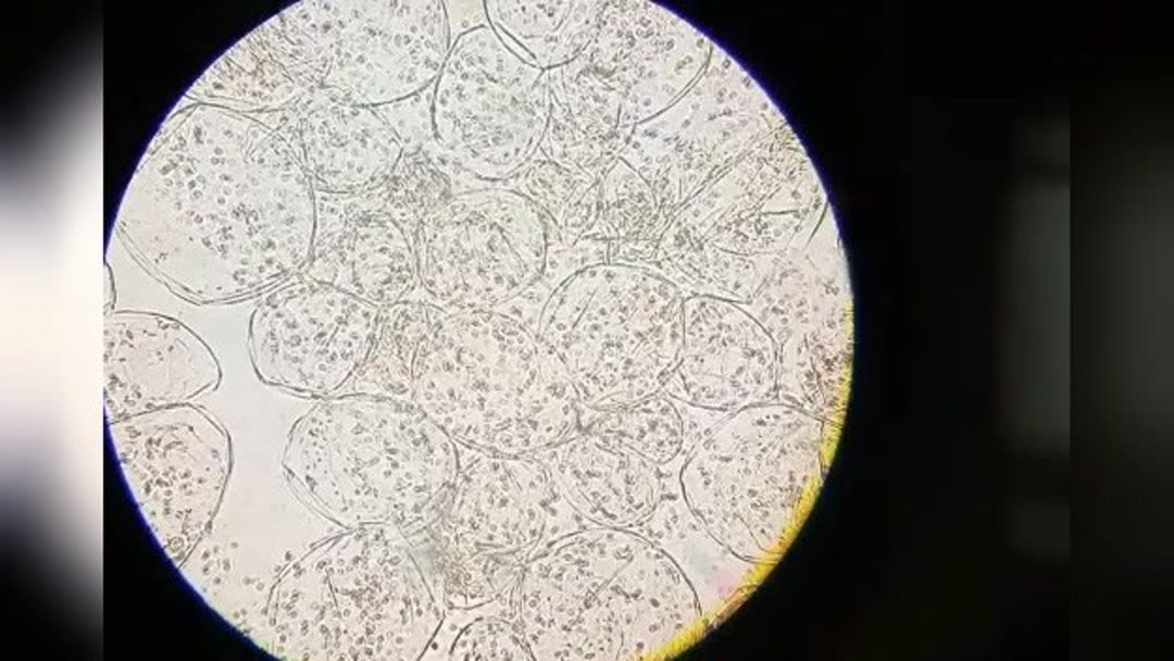 用显微镜观察番茄果肉细胞-哈云课堂