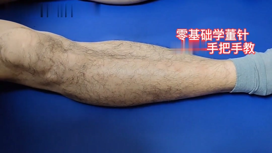 董氏奇穴侧三里侧下三里,治疗面瘫_偏头痛等症状