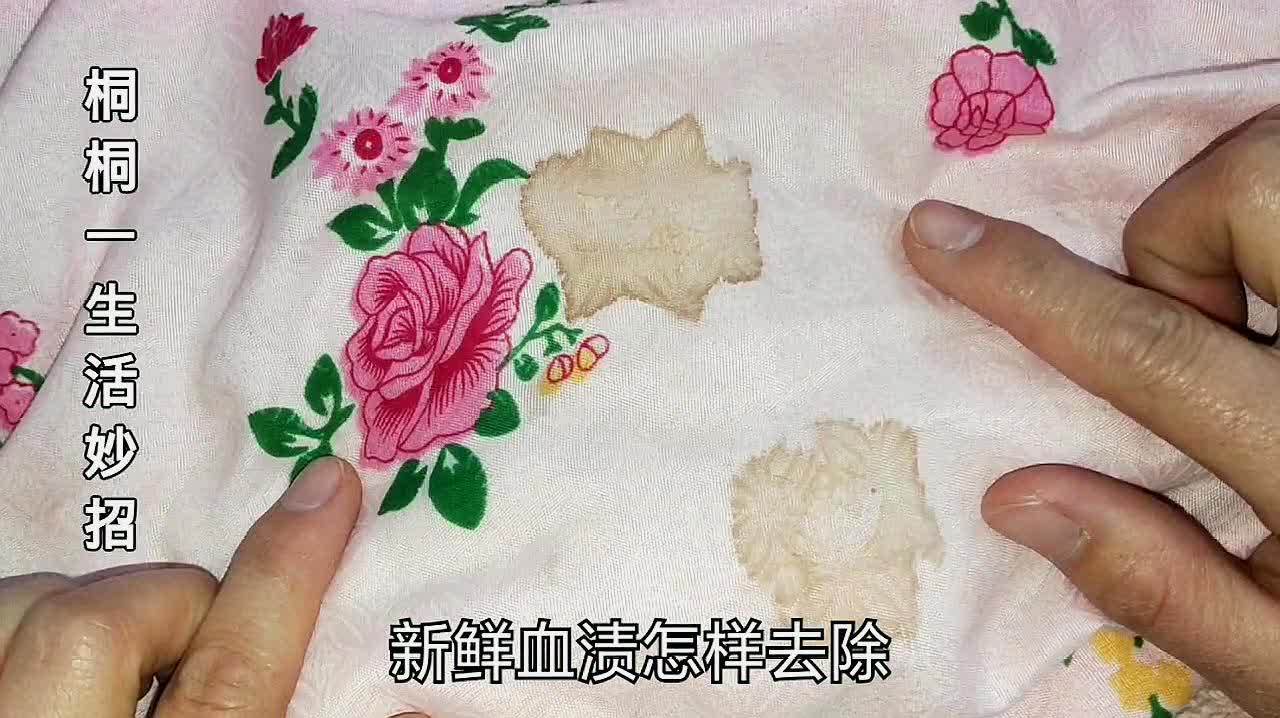 姨妈血沾到被褥上,不用一滴水清洗干净