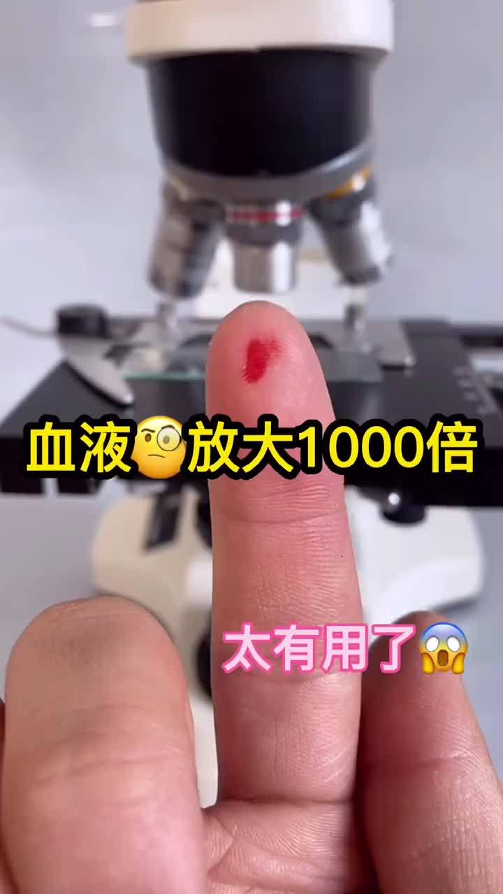 所以保护好我们的血液其实是很重要的显微镜涨知识