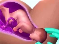 3D模拟演示生孩子的过程,孕妇疼痛难忍,看着都心疼