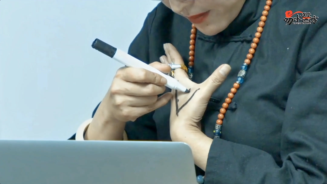 舒卿老师详解气血三针的位置