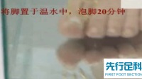 先行足科嵌甲矫正器使用视频