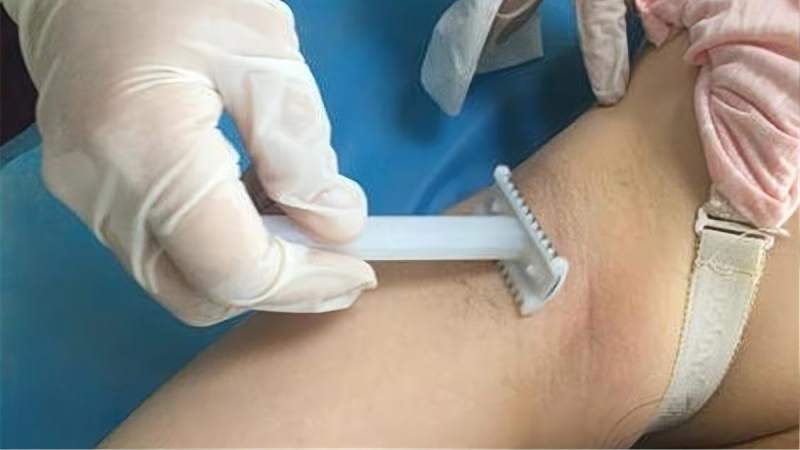 为何女性在生产前都需要被刮毛?镜头记录分娩全程,别不好意思看