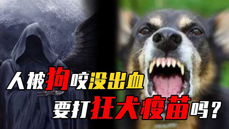 被狗咬了,没出血,要打疫苗吗?盘点“狂犬病”7大谣言和误区!