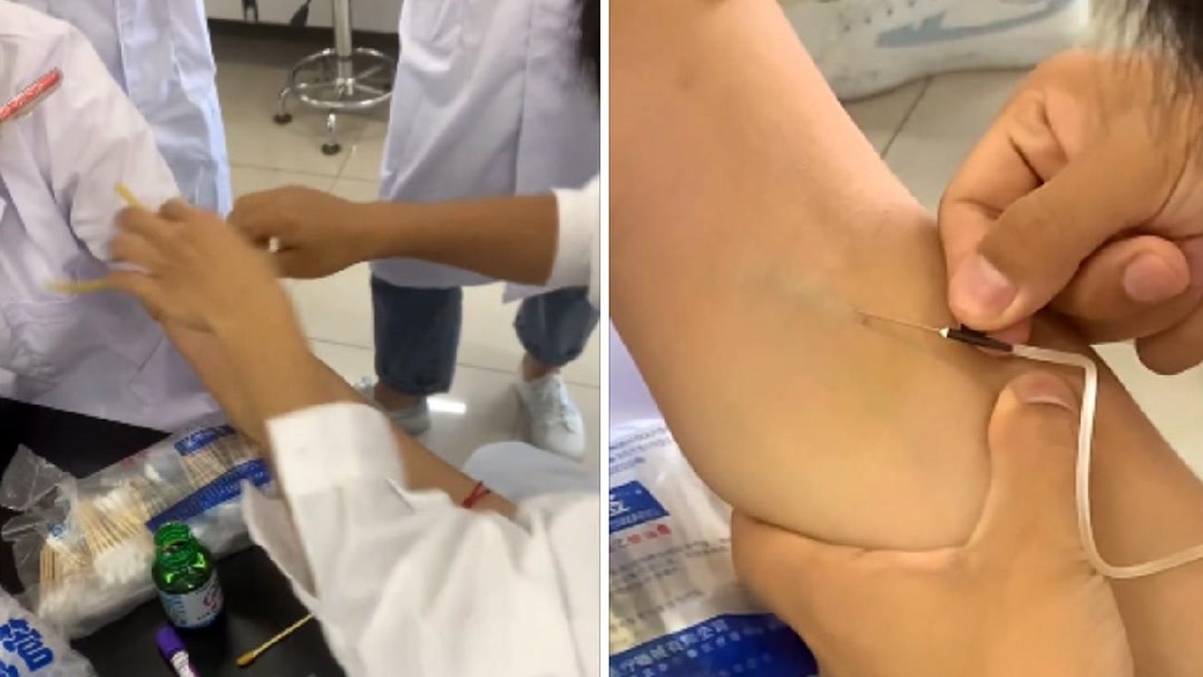 医学生拿同学扎针练手,眼瞅着即将扎进去,手一抖针跑了