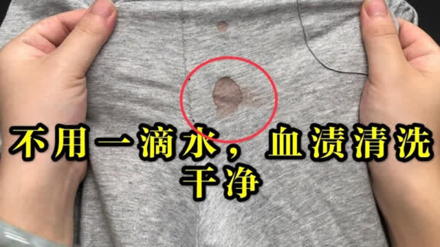 不管衣物上血渍多顽固,不用一滴水,新老血渍轻松洗掉