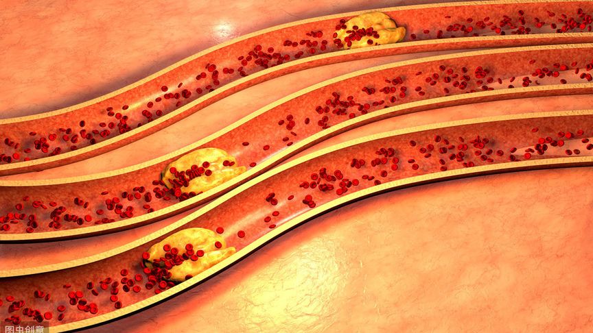 若血管堵塞,会有这5个表现,推荐四种食物,疏通血管不再愁!