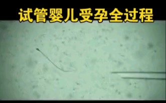 试管婴儿受孕全过程