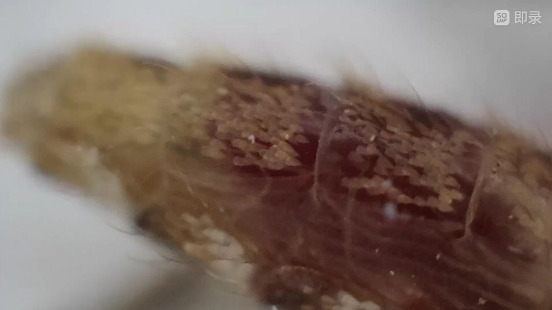 微观蚊子——背血管