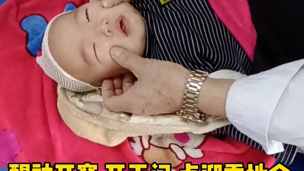 开天门 醒脑开窍