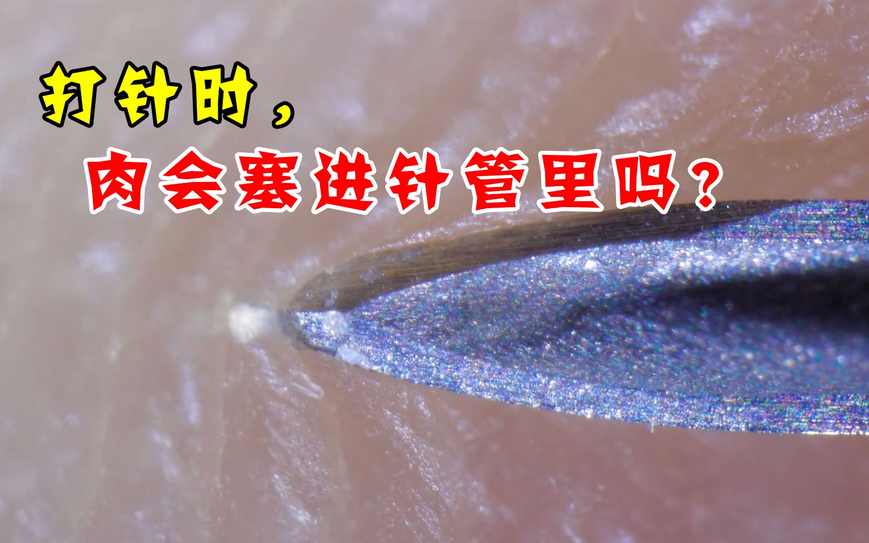 打针时,身体上的肉会不会塞进针管里?肉都去哪儿了?