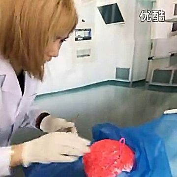 米米:痔疮切割手术全过程