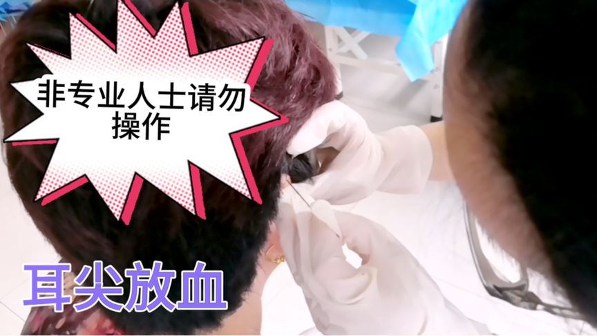 失眠调理之耳尖放血