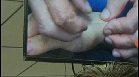 庞承泽戒烟阳溪透列缺