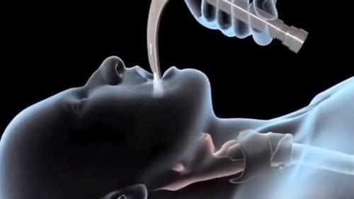 呼吸机的工作原理,动画还原整个过程,扩张血管促进肺的活动次数 (1)