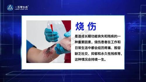 案例|干细胞对烧伤愈合的1期试验研究