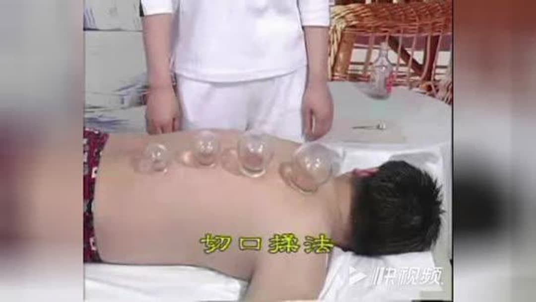 中医教学视频——拔罐