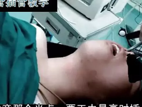 气管插管教学