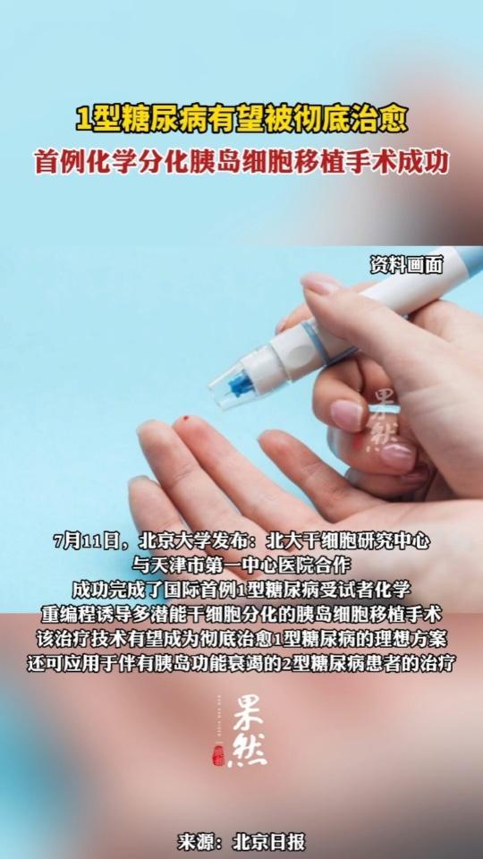 1型糖尿病有望被彻底治愈 首例化学分化胰岛细胞移植手术成功