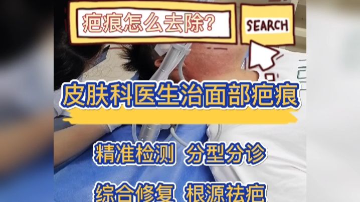 面部有难看的疤痕怎么祛除?